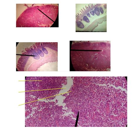 Lymphatic System Lab 8 Diagram Quizlet