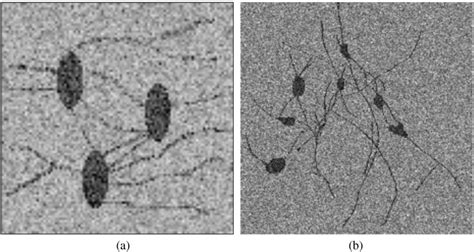 Minimum Intensity Projection Minip Views Of Two Different Image