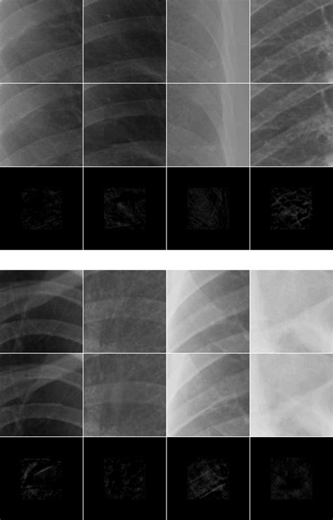 Chest X Rays Image Inpainting With Context Encoders Deepai