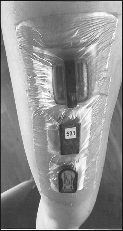 Illustration Of Accelerometer Placement Top To Bottom Actigraph Download Scientific Diagram