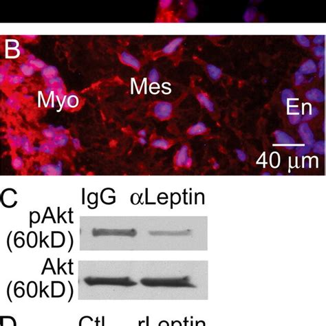 Spatiotemporal Localization Of Leptin During Endocardial Cushion Download Scientific Diagram