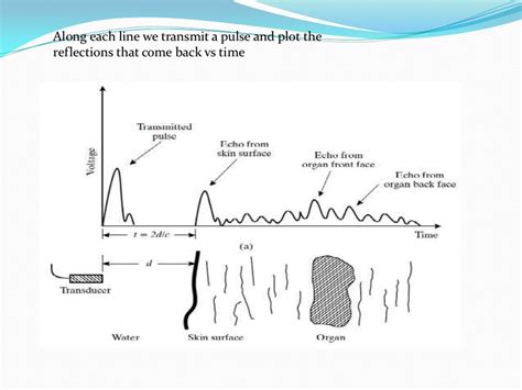 Ultrasound Imaging Principles