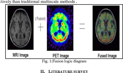 Figure 1 From Fuzzy Logic Based Multi Modal Medical Image Fusion Of Mri