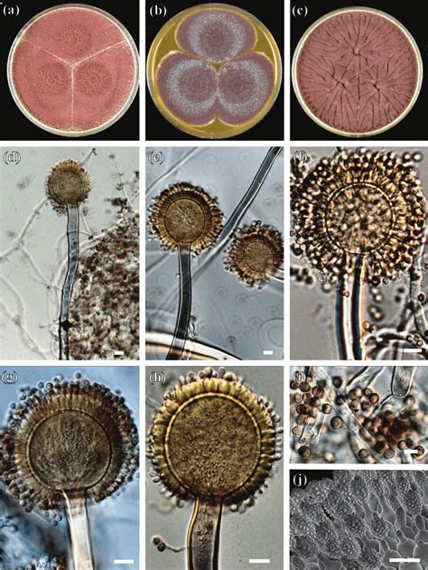Aspergillus Aculeatinus Sp Nov Cbs 121060 T Ac Colonies On A