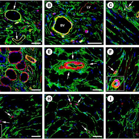 Morphology Of Human Synovium Lining And Sublining Layers Under Light