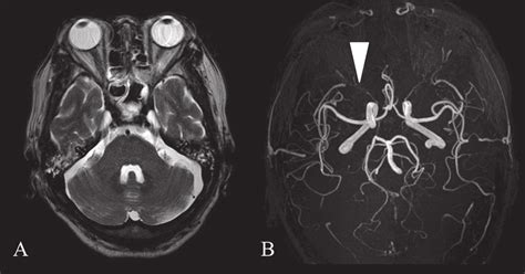 Magnetic Resonance Analysis Fig 5a The Brain Magnetic Resonance