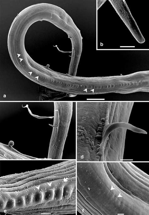 Nematode Electron Microscope