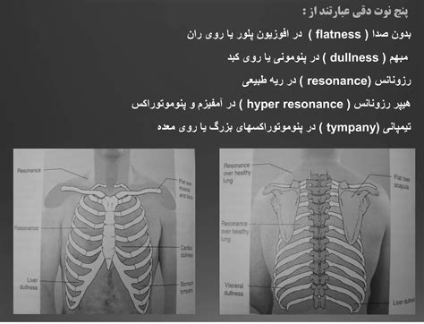جزوه وضعیت قفسه سینه و ریه ها جزوه بان