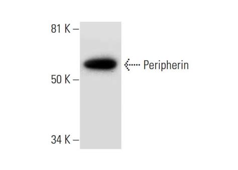 Anti Peripherin Antibody A 3 Scbt Santa Cruz Biotechnology