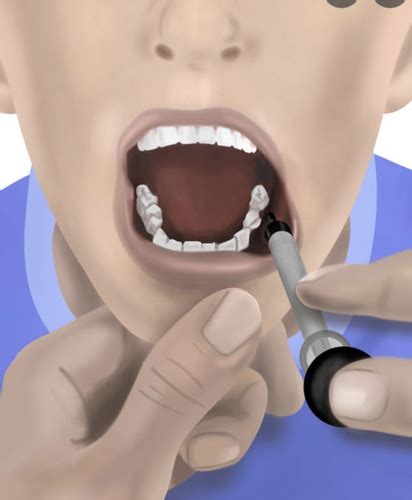 EMT Pharmacology Flashcards Quizlet