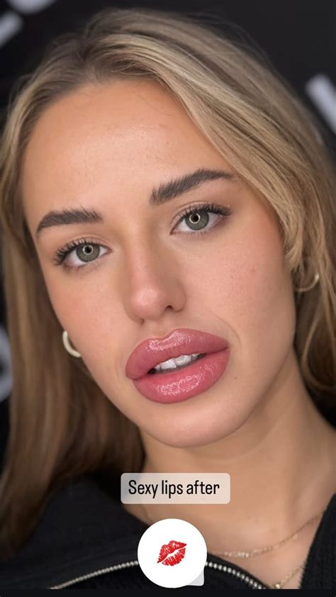 Mackenzie Salmon Usa Today Sports Rhotreporters