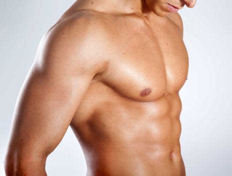 Bicep Implants Gone Wrong