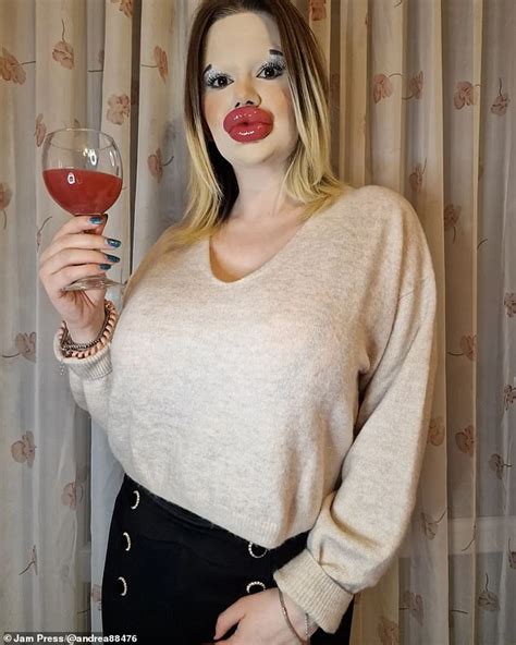 I Spent 8 000 To Get The World S Biggest Lips Now I M Having Jabs To