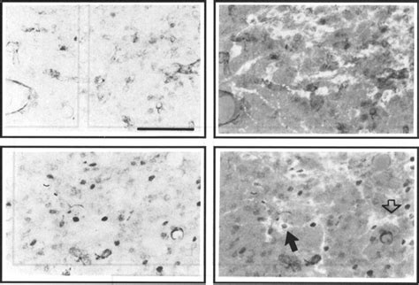 Sections Through The Medial Parvocellular Subdivision Of The Pvn In