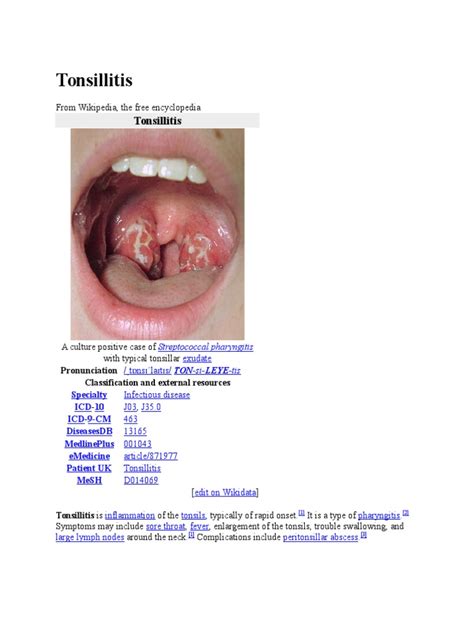 Tonsillitis Pdf Respiratory Diseases Epidemiology