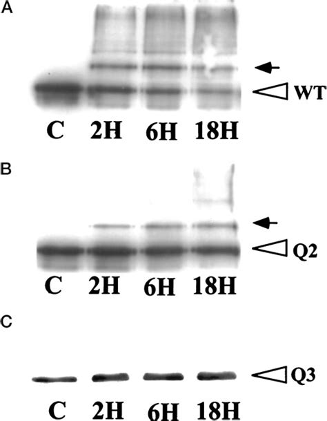 Covalent Cross Linking Of Fibronectin To Fibrin Is Required For Maximal
