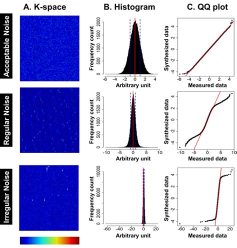 Troubleshooting And Quality Assurance In Hyperpolarized Xenon Magnetic