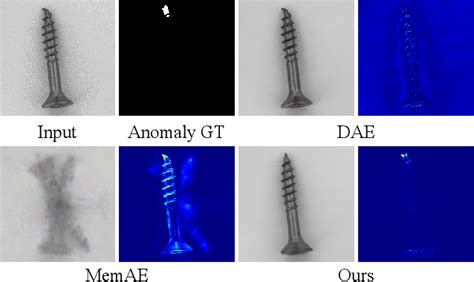 figure 7 from learning semantic context from normal samples for unsupervised anomaly detection