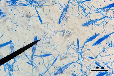 Microscopic Morphology Of Isolate Microaleuriospores Stalked And In