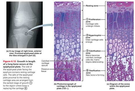Photomicrograph Of Bone