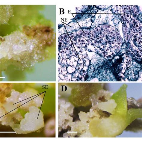 Adventitious Vegetative Bud Regeneration Via Direct Organogenesis Of
