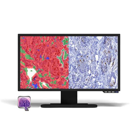 Histopathology Laboratory Software Module PatternQuant 3DHISTECH