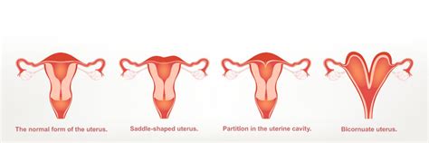 Woman Health Pain In Uterus Gynecology Royalty Free Vector