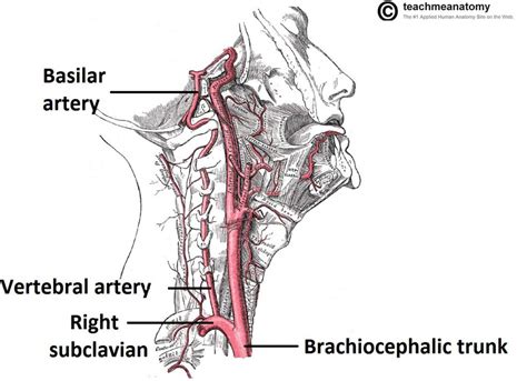 Subclavian Steal Syndrome Teachmesurgery