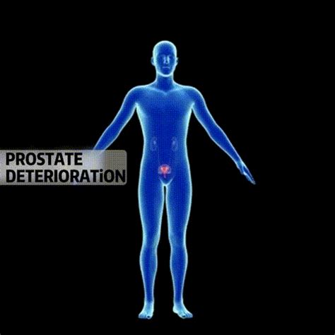 Prostaluxe™ Prostate Atomizing W I Z Z G O O C O M