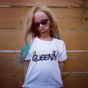 Adalia Rose Youtuber Wiki Bio Age Height Weight Boyfriend Net Worth Family Facts