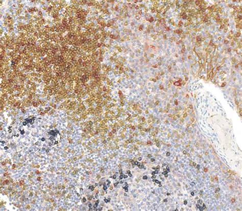 What Are The Different Detection Methods For Ihc Enzo