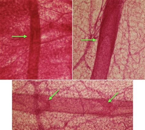 Lymphatic System Flashcards Quizlet