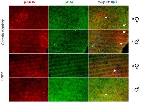 Sex Differences In Map Kinase Activation In The Periaqueductal Gray