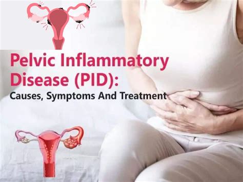 Pelvic Inflammatory Disease 9 Unusual Signs Your Reproductive System