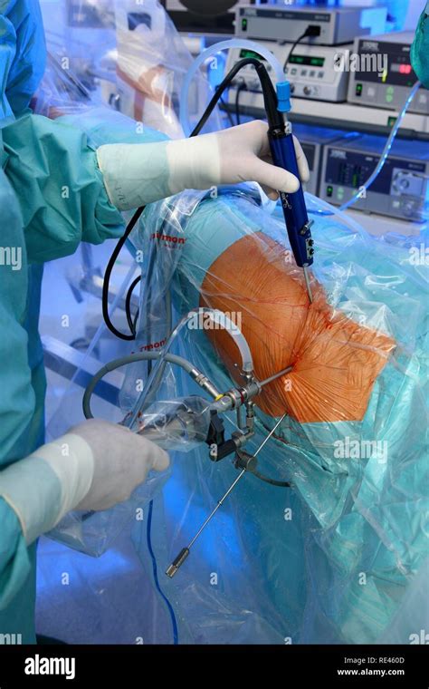 Arthroscopie De La Hanche La Hanche L Endoscopie La Chirurgie Mini Invasive De La Hanche Photo