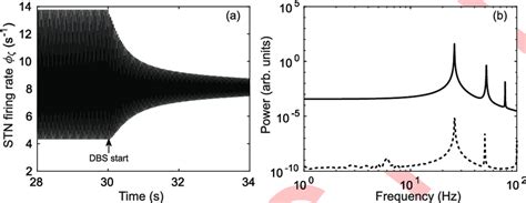 Suppression Of Parkinsonian Beta Activity For A 150 Hz External