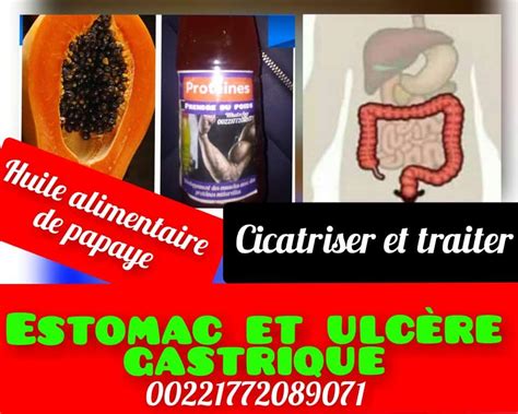 Ulcere Gastrique Et Estomac