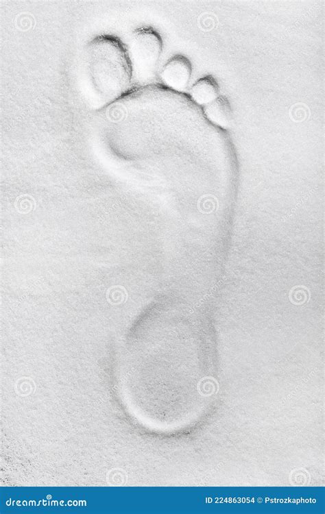 Diabetic Foot Skin With Sebaceous Secretions On The Human Heel Close
