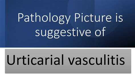 Urticarial Vasculitis Diagnostic Challenge In 2 Cases Ahmed Yehia Md