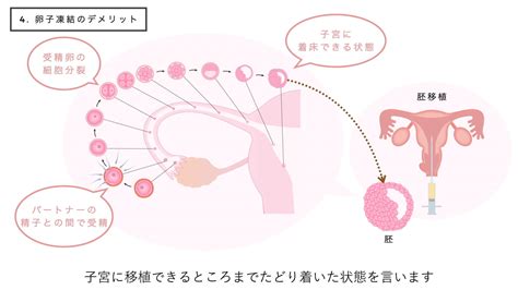 日本産科婦人科学会（ノンメディカルな卵子凍結） Aquarius Movies｜アクエリアス・ムービー
