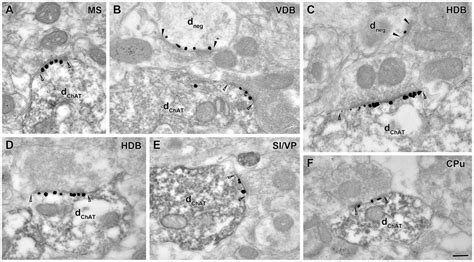 Cholinergic Projection Neurons Of The Basal Forebrain And Neostriatal
