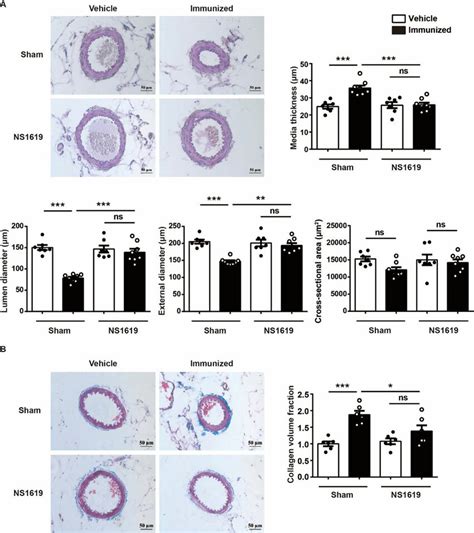 NS1619 Perfusion Reversed The Remodeling And Perivascular Fibrosis Of
