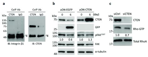 CTEN acts as a binding partner of integrin β1 and increases the