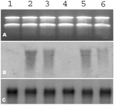 Northern Blot Hybridization Analysis Showing Differential Expression Of
