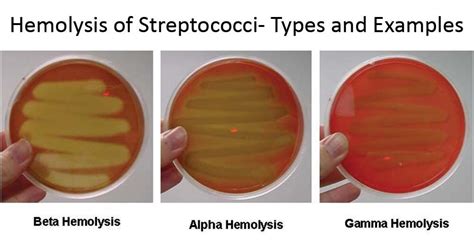 Hemolysis Of Streptococci Types And Examples Medical Technology