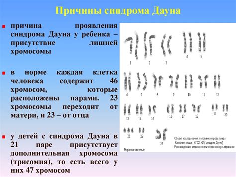 Дети с синдромом Дауна Особенности личности Перспективы развития презентация онлайн