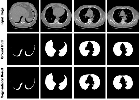 Segmentation Results Of The Proposed Method On Lung Dataset The Download Scientific Diagram