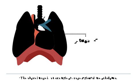 Stage 3 Mesothelioma Treatment And Life Expectancy