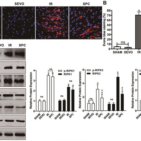 Spc Inhibited Necroptosis And The Up Regulation Of Ripk3 Mlkl Proteins