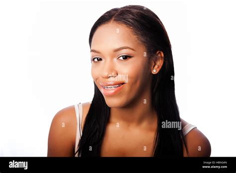 Beautiful People With Braces
